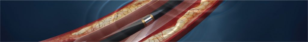 Meet The Team - Innovative Vascular Partners